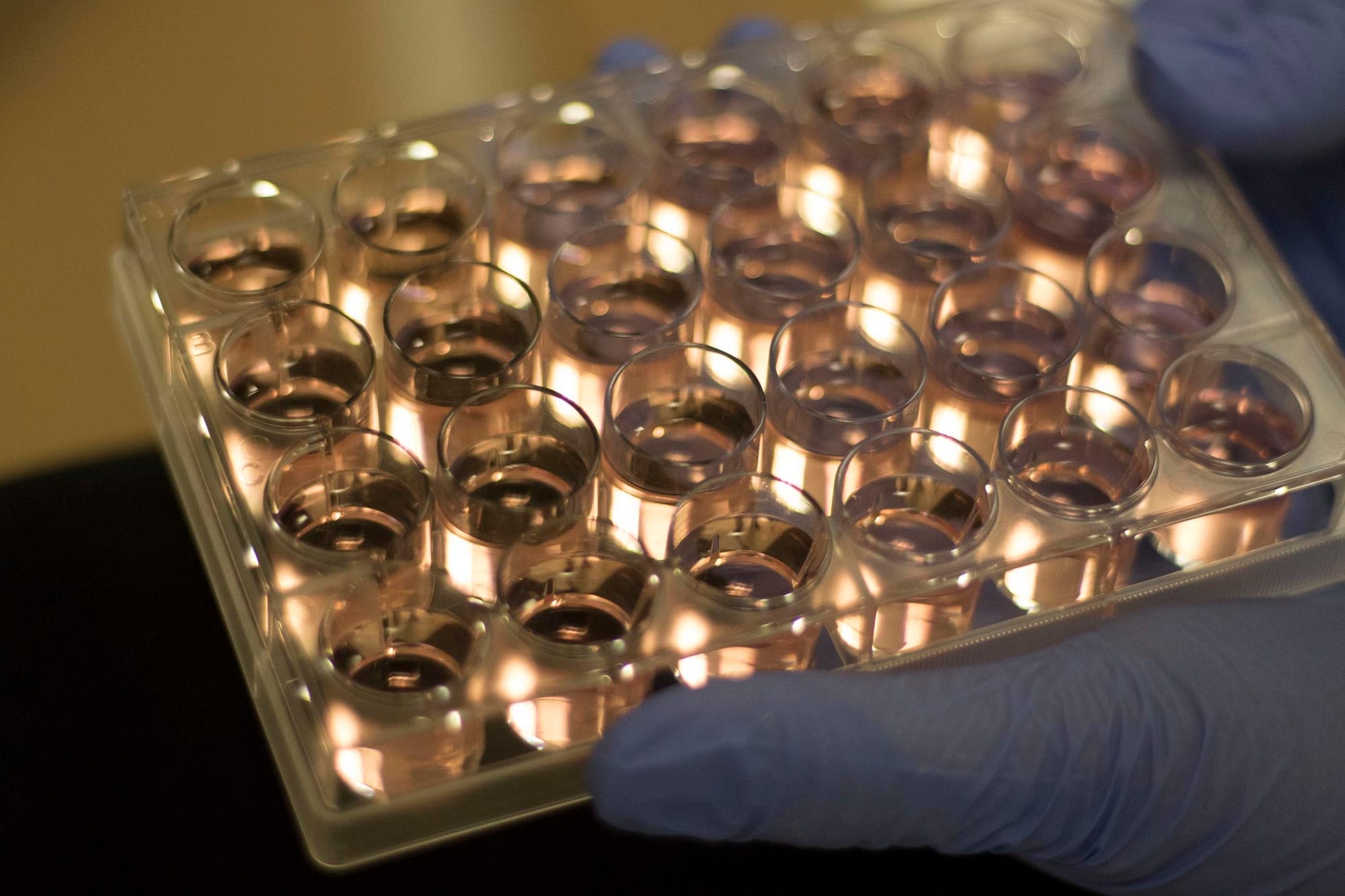 Drug discovery | DNDi